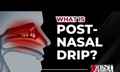 Transnasal Esophagoscopy (TNE) | ENT and Allergy Associates