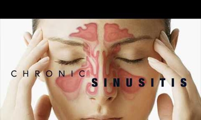 Nose - What is Post-nasal Drip Syndrome? | ENT and Allergy Associates