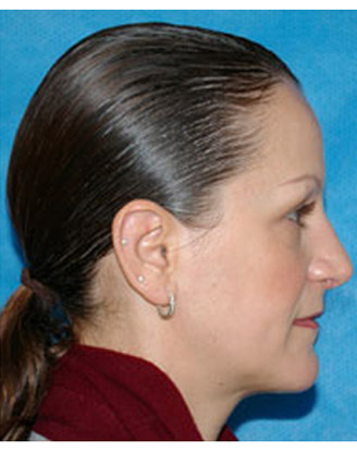 Dr. Guy Lin | ENT and Allergy Associates