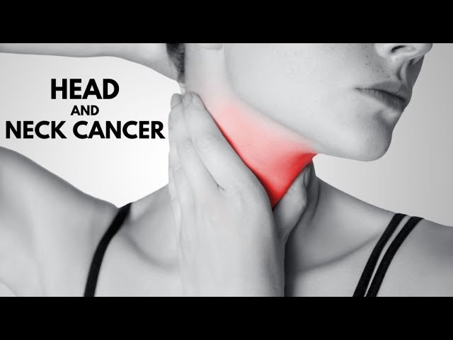 Head & Neck Cancer with Dr. Jack Russo | ENT and Allergy Associates