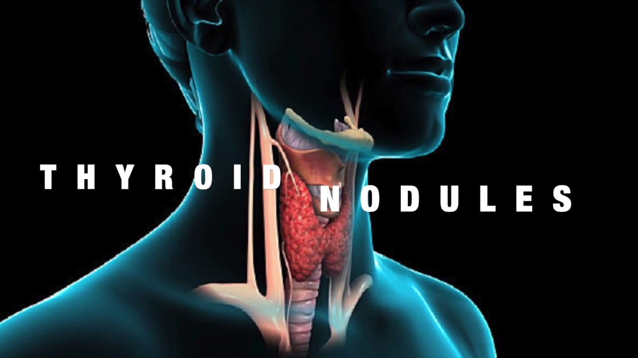Thyroid Nodules with Dr. Jack Russo | ENT and Allergy Associates