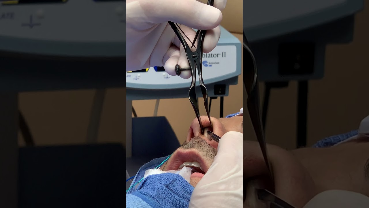 Septoplasty - Septal Incision | ENT and Allergy Associates