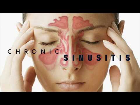 Chronic Sinusitis with Dr. David Mener | ENT and Allergy Associates